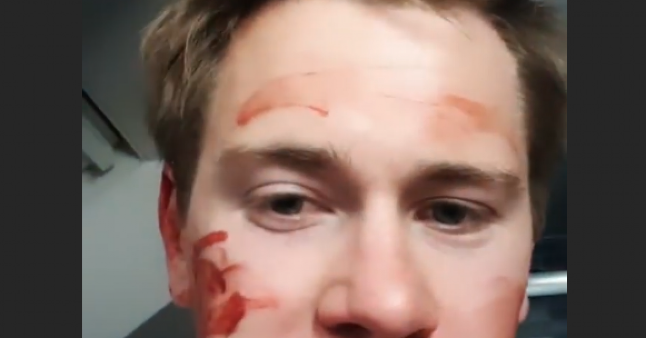 Sportske novosti - FOTO: 'NIJE DOBRO ZAVRŠILO! ZREZO SAM SE, NIŠ', GLUP ...