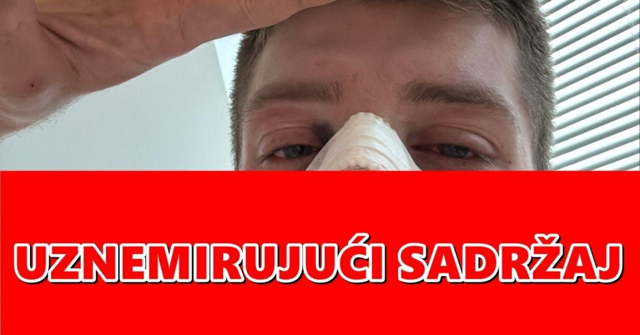 Sportske novosti - Dvostruki prijelom nosa bez sankcija, Tucak ogorčen ...