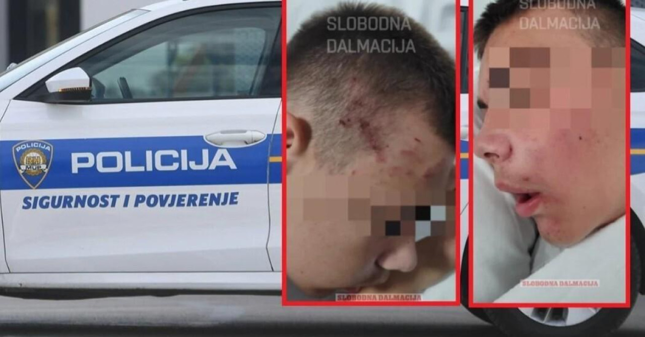 Jutarnji list - Preokret u stravičnom slučaju premlaćivanja djeteta ...